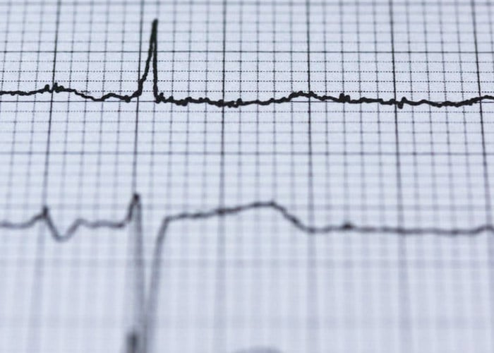 Heart Rate Recovery How To Measure Yours heart-rate-recovery-how-to-measure-yours